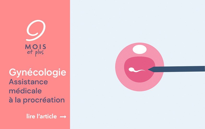 Les techniques d'assistance médicale à la procréation (AMP) - 9moisetplus